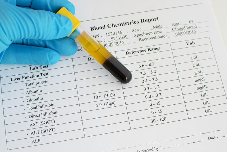 Urobilinogen in Urine: Low & High Levels + Normal Range - SelfHacked
